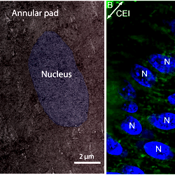 Overview of the capsule and annular pad.