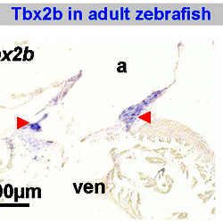 Tbx2 expression in the atrioventricular canal of the formed heart of ...