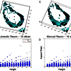 Automatic vs. Manual Segmentation.