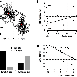 Center of pressure (COP) during posturographic tests.