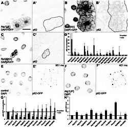 Loss of known autophagy regulators enhances p62 puncta formation cell ...