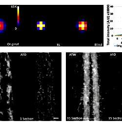 Two-dimensional Richardson-Lucy deconvolution of array tomographic images.