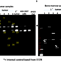 Clonality analysis for genomic DNA samples extracted from primary and ...
