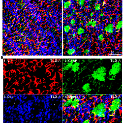 Whole mount staining revealed increased GFAP staining and scar-like ...