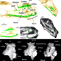 Three-dimensional reconstruction of the maxillary canal, mandibular ...