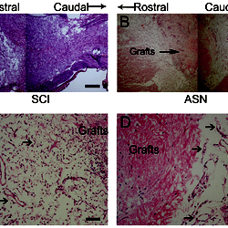 HE staining in longitudinal section of transected area after SCI 8th ...
