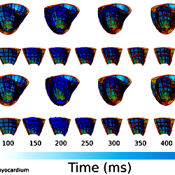 Plot of local work (A) pre- and (B) post-CRT, yellow spheres correspond ...