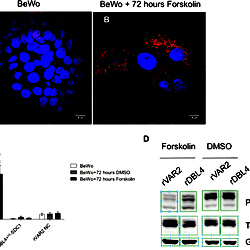 Co-localization between placental CS and SDC1 on BeWo cells before and ...