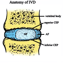 The structure of anatomy of the IVD.