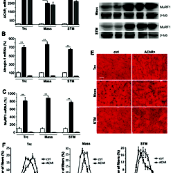 Denervation and atrophy in triceps (Trc), masseter (Mass) and ...