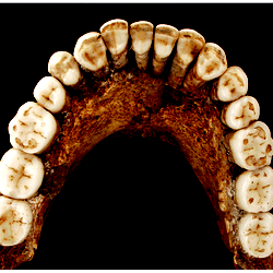 Occlusal view of Regourdou 1 mandible.