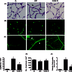 Effect of KIOM-79 on histopathological changes.