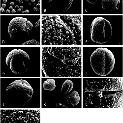Comparative Pollen Morphological Analysis and Its Systematic ...