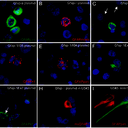 Expression of GFAP isoforms results in different IF network morphologies.