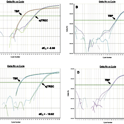 Typical illustrations of sjTREC and TBP amplification curves.