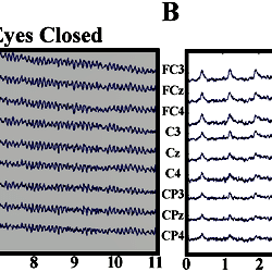 Two examples of raw EEG data with different types of artifacts.