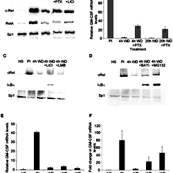 Transcriptional down-regulation of the GM-CSF gene is dependent on the ...