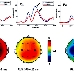 Event-related potential (ERP) waveforms and topography of the P300 ...