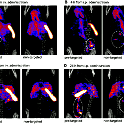 SPECT-CT imaging.