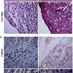Sch B inhibits local invasion of 4T1 cells in vivo.