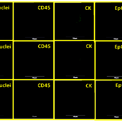 Representative, confocal images of an enriched peripheral blood samples ...