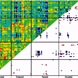 Paired differences of the brain connectivity matrices between the young ...