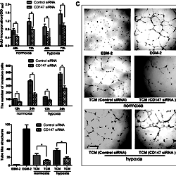 HUVEC proliferation, migration and formation of capillary-like ...