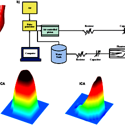 The Effect of Spatial and Temporal Resolution of Cine Phase Contrast ...