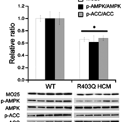 Modification of AMPK signaling axis in R403Q HCM hearts.