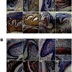 Immunocytochemistry of melatonin receptors in developing first molar ...