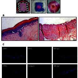 Tissue Engineered Model of Human Skin.