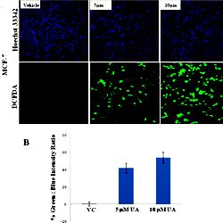 The effect of UA on ROS generation was determined using DCF-DA assay in ...