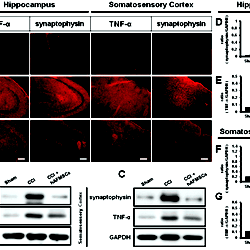 Expression of TNF-α and synaptophysin in hippocampus and somatosensory cortex after hAFMSCs ...