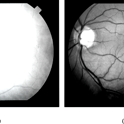 Retinal RGB image and its channels visual inspection.