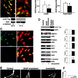 VEGF knockdown podocyte model.