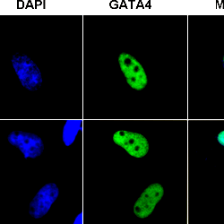 Normal subcellular distribution of GATA4 mutant protein.