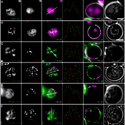 Partial colocalization of Ist2 and Pma1 in network-like structures.