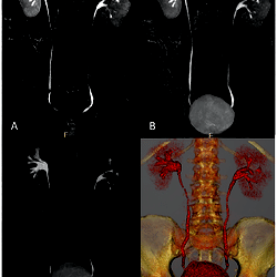 The value of MR imaging at different time intervals.