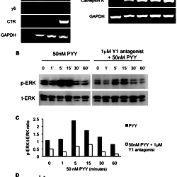 PYY signalling in osteoblasts via Y1 receptors.