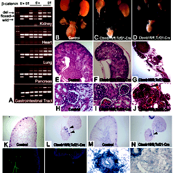 Ctnnb1fl/fl;Tcf21-Cre mice shows hydroureter or rudimentary kidneys.