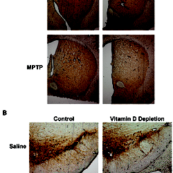 25(OH)D depletion does not exacerbate loss of tyrosine hydroxylase ...