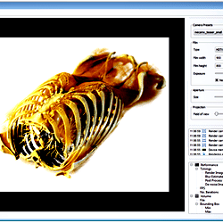 Screenshot of the Exposure Render graphical user interface.