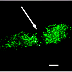 Imaging of the transection site.