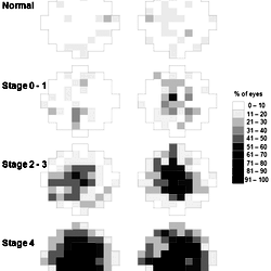 Frequency of defect maps.