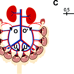 Comparison of conventional reduced uterine perfusion pressure (RUPP ...
