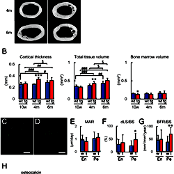 Micro-CT and bone histomorphometric analyses of cortical bone (A, B ...