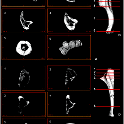CT scan images of humerus and ulna displaying cross-section morphology.