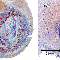 Examples of pimonidazole staining patterns.