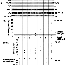 Validation of the novel fibrosis markers by Western blotting indicates ...