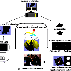 Overall schematic of a planning and US image-based navigation system ...